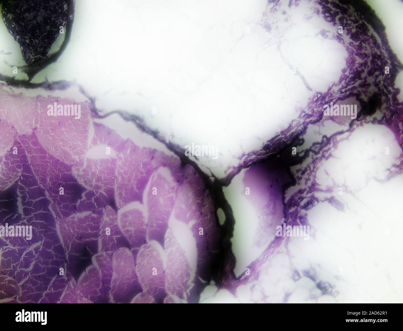 Skeletal muscle and nerve bundle. Digitally enhanced light micrograph ...