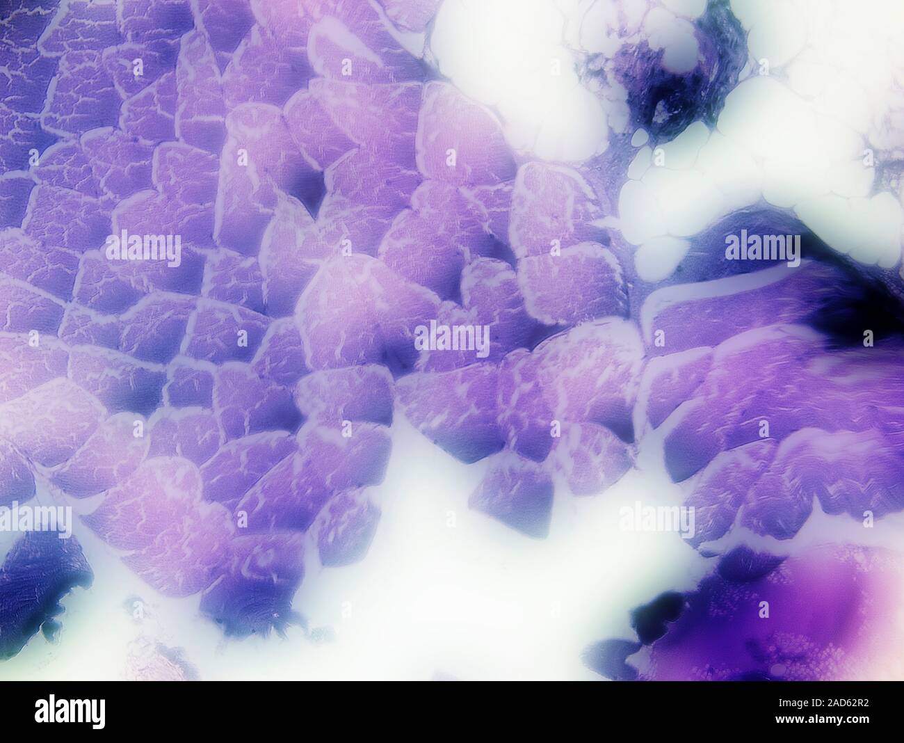 Skeletal muscle. Digitally enhanced light micrograph of a thin section ...