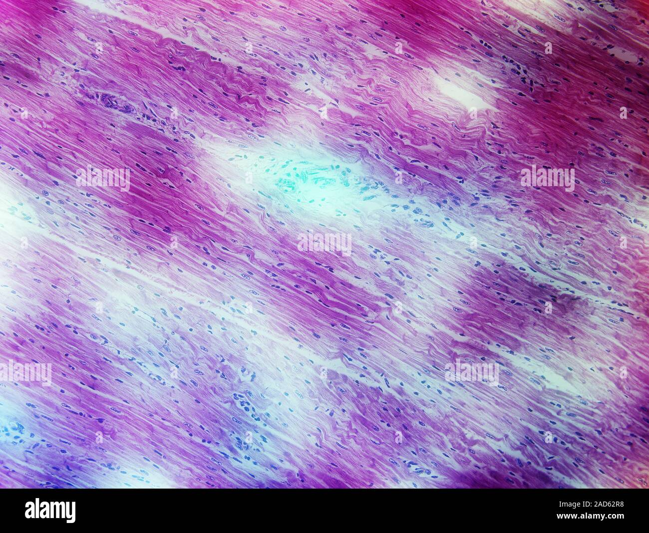 Cardiac muscle. Digitally enhanced light micrograph of heart tissue ...