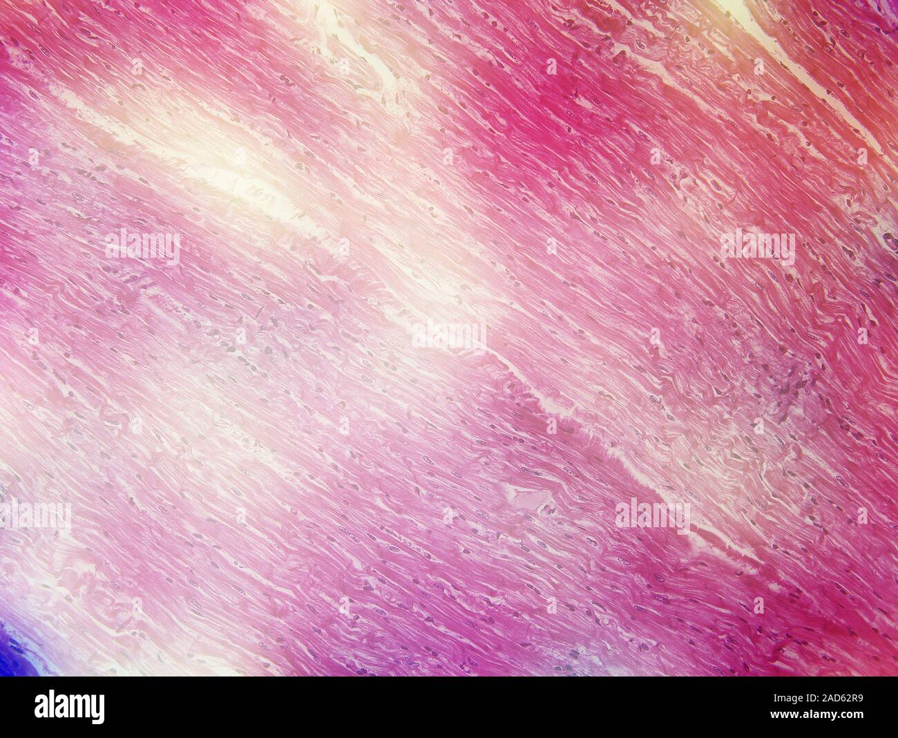 Cardiac muscle. Digitally enhanced light micrograph of heart tissue ...
