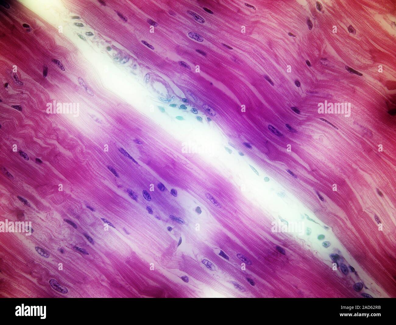 Cardiac muscle. Digitally enhanced light micrograph of heart tissue ...