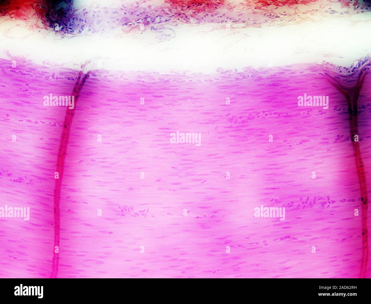 Small intestine tissue. Digitally enhanced light micrograph of tissue ...