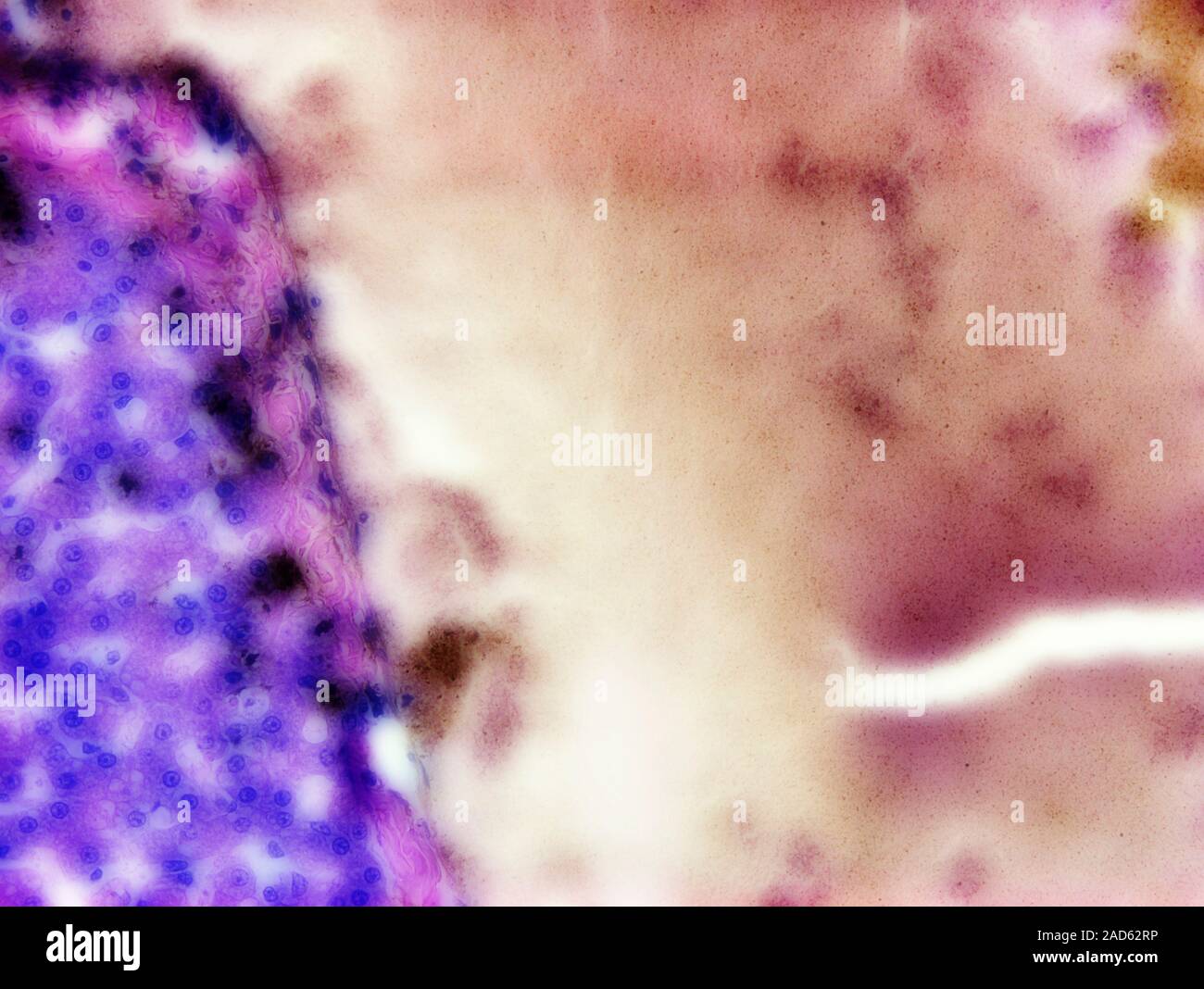 Liver tissue. Digitally enhanced light micrograph of a thin section ...