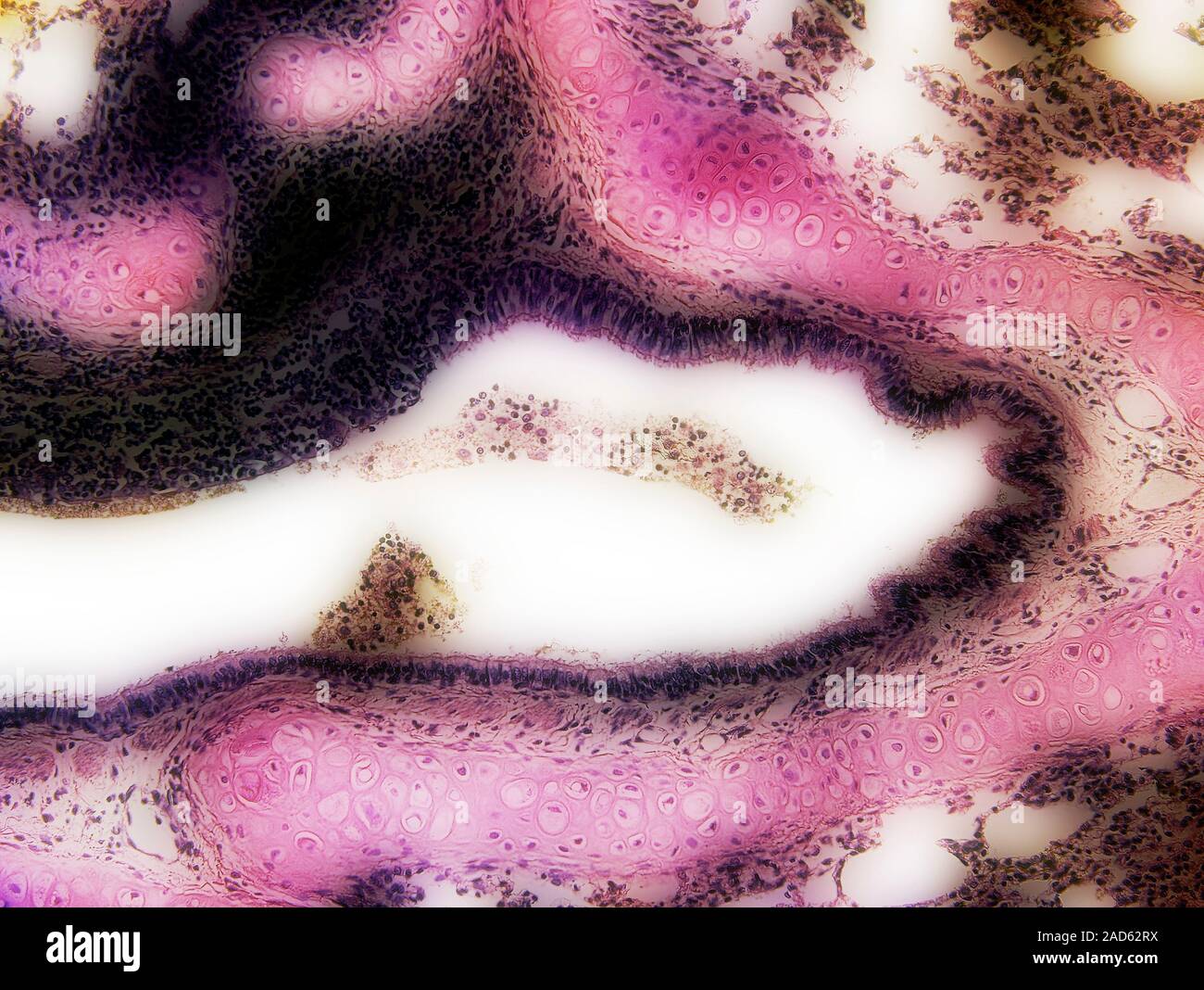 Bronchus in lung tissue. Digitally enhanced light micrograph of a thin ...