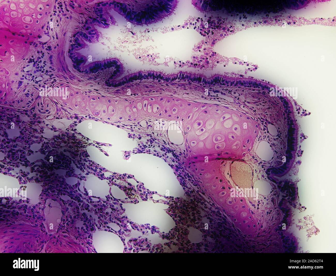 Bronchus in lung tissue. Digitally enhanced light micrograph of a thin ...