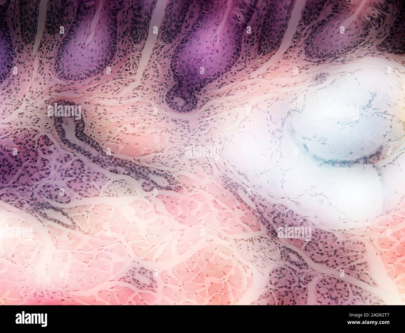 Tongue tissue. Digitally enhanced light micrograph of a thin section ...