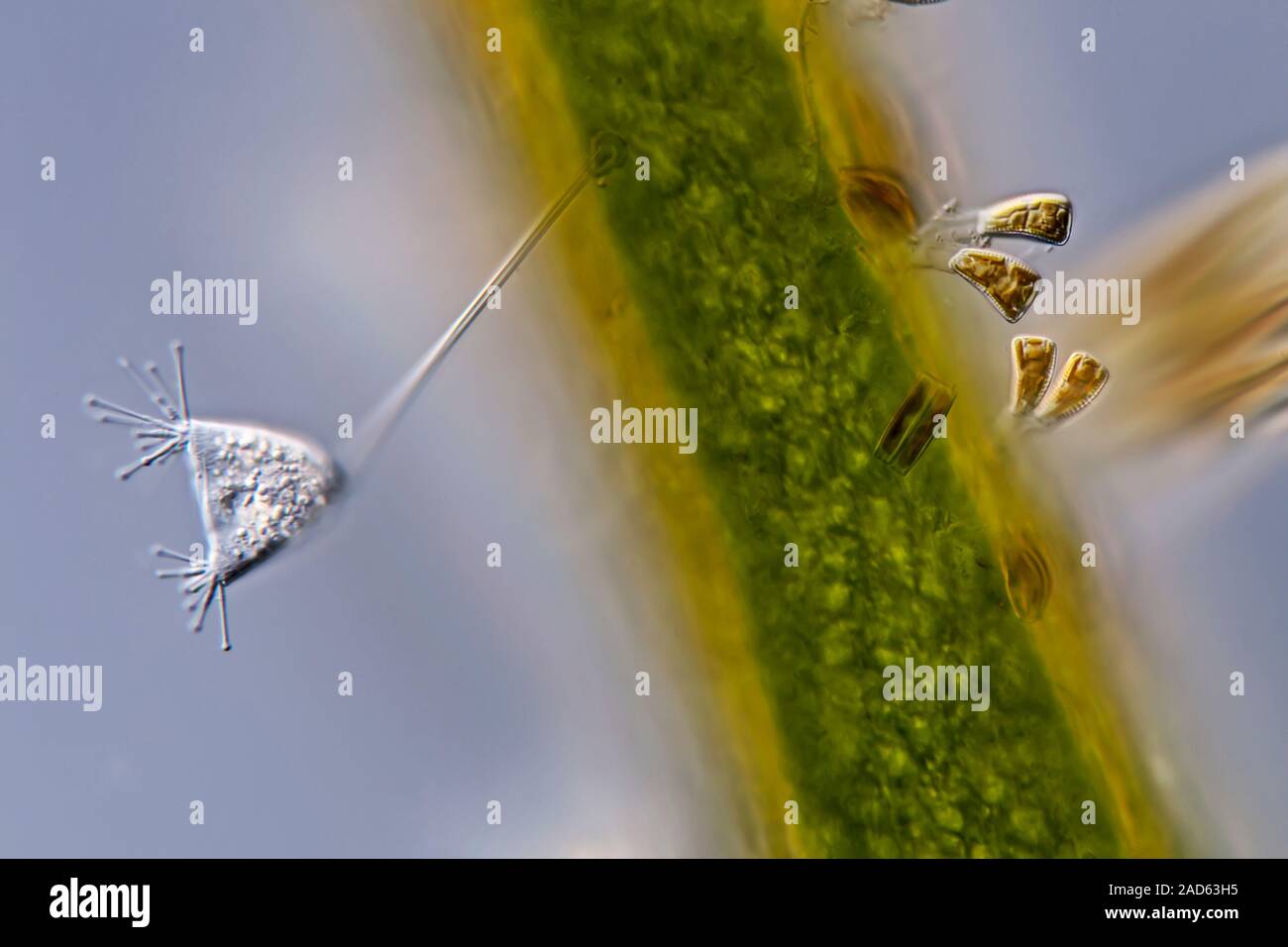 Light micrograph of a sessile suctorian ciliate Acineta tuberosa ...