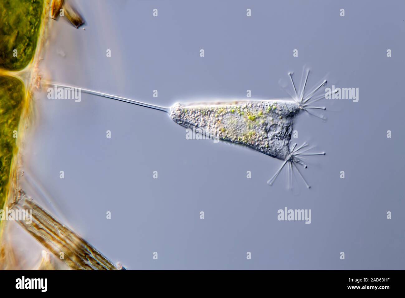 Light micrograph of a sessile suctorian ciliate Acineta tuberosa ...