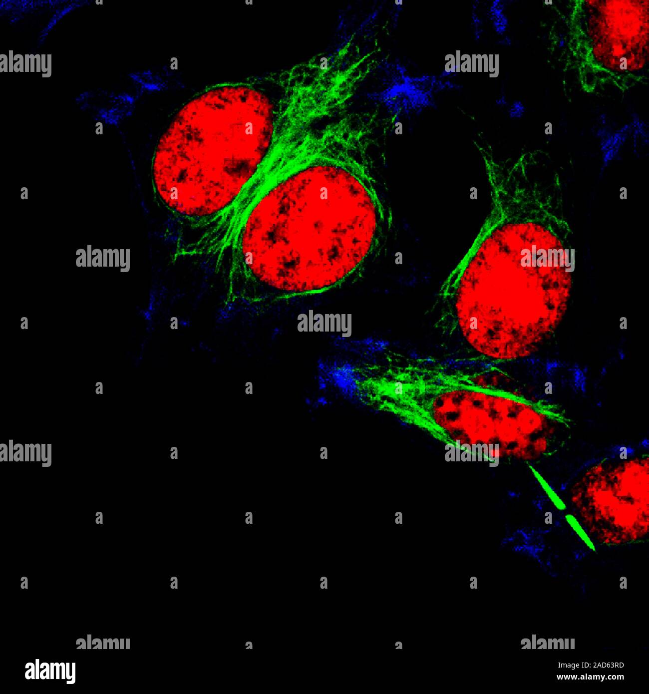 HeLa cervical cancer cells. Fluorescence light micrograph of HeLa ...