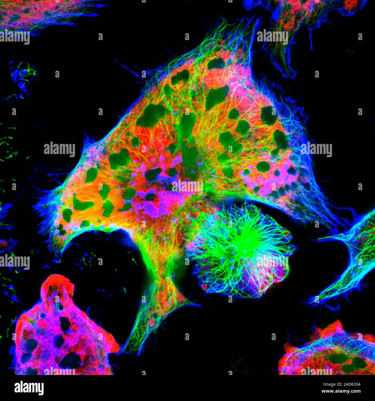 Neuroblastoma cells. Fluorescence light micrograph of cells from a type ...