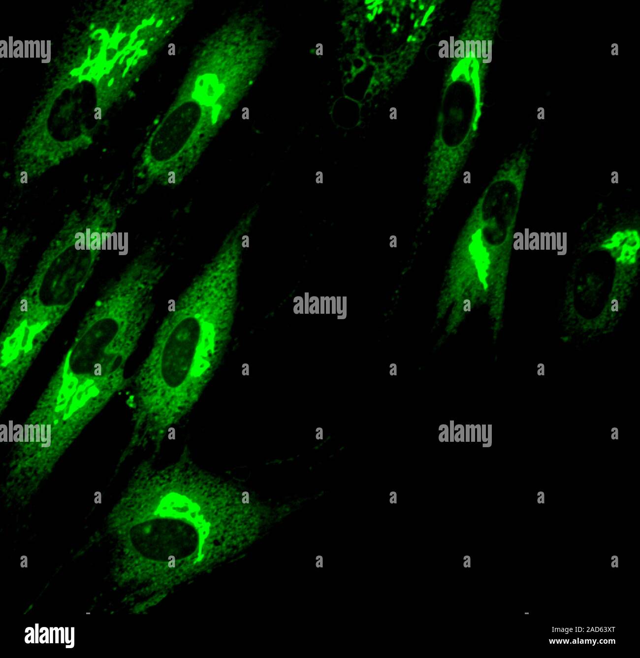 Fibroblast skin cells. Fluorescence light micrograph of fibroblast ...