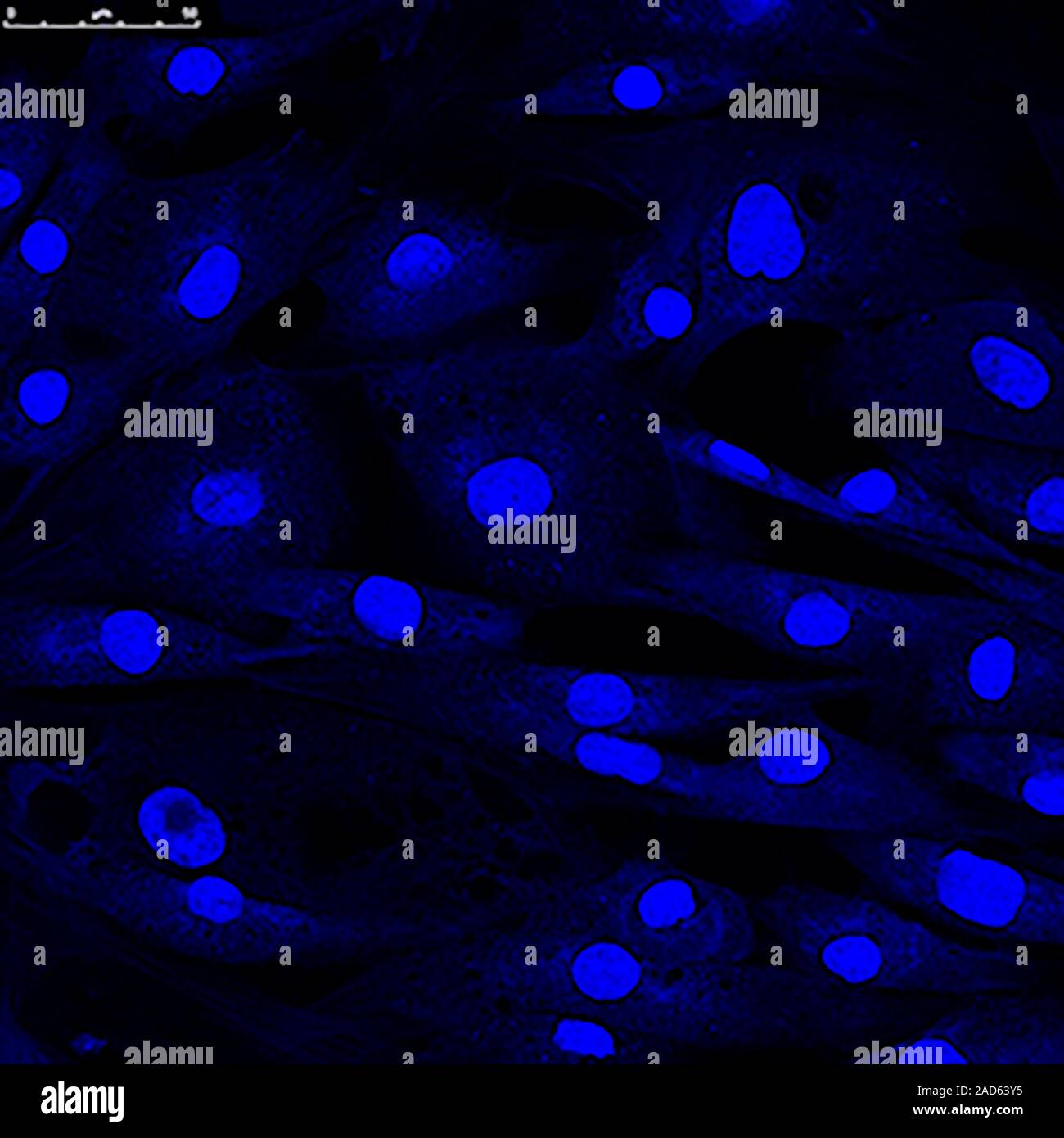 Fibroblast skin cells. Fluorescence light micrograph of fibroblast ...
