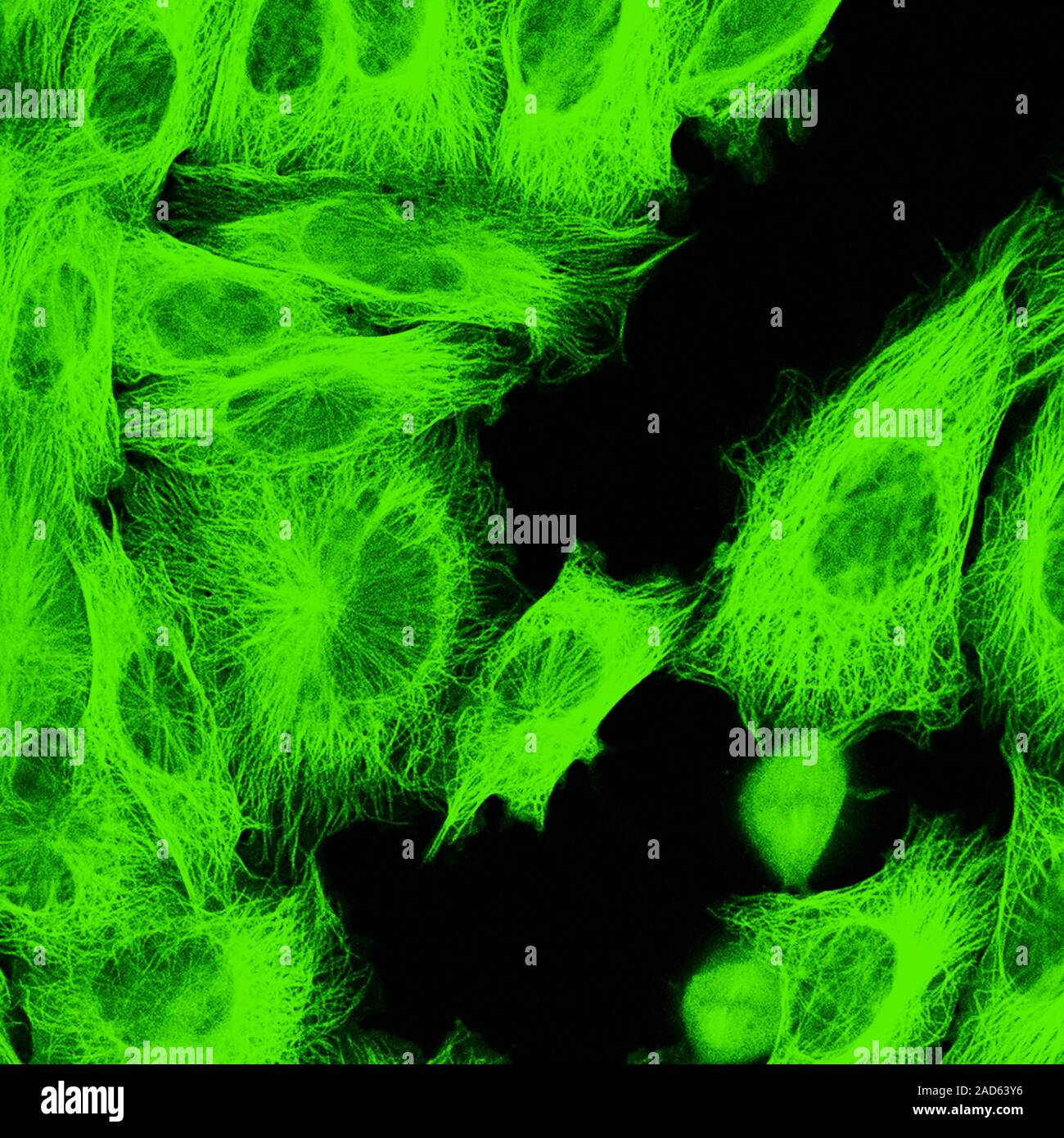 Fibroblast skin cells. Fluorescence light micrograph of fibroblast ...