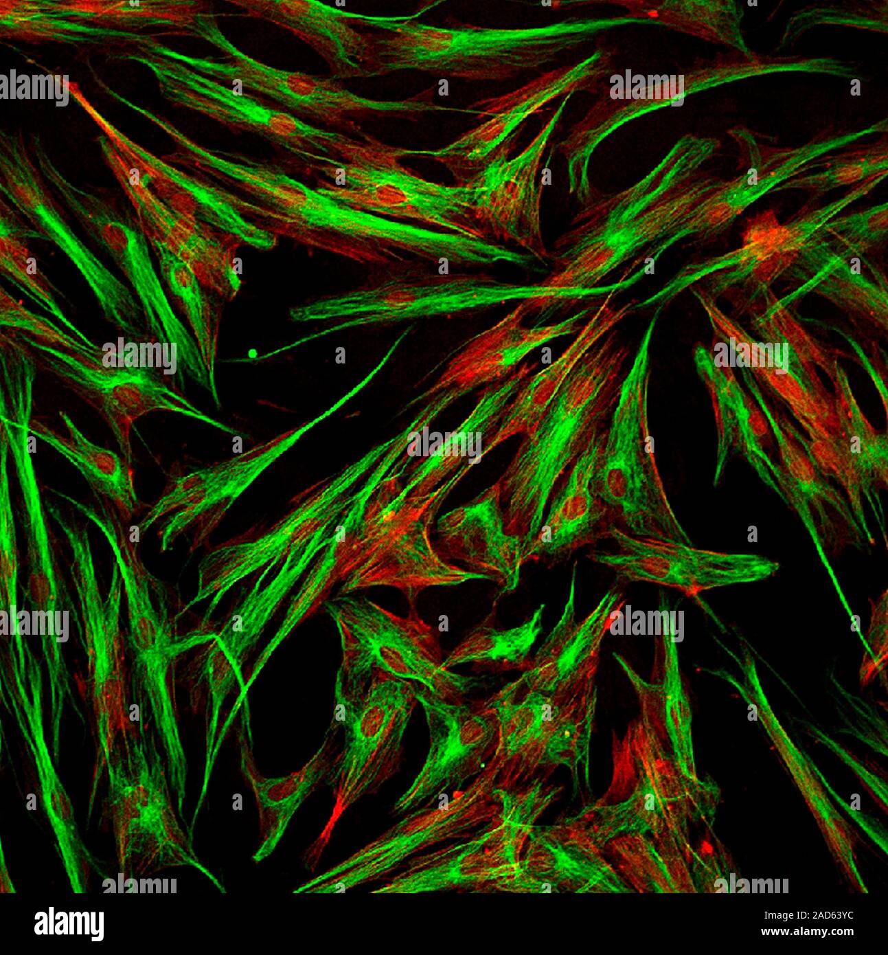 Fibroblast skin cells. Fluorescence light micrograph of fibroblast ...