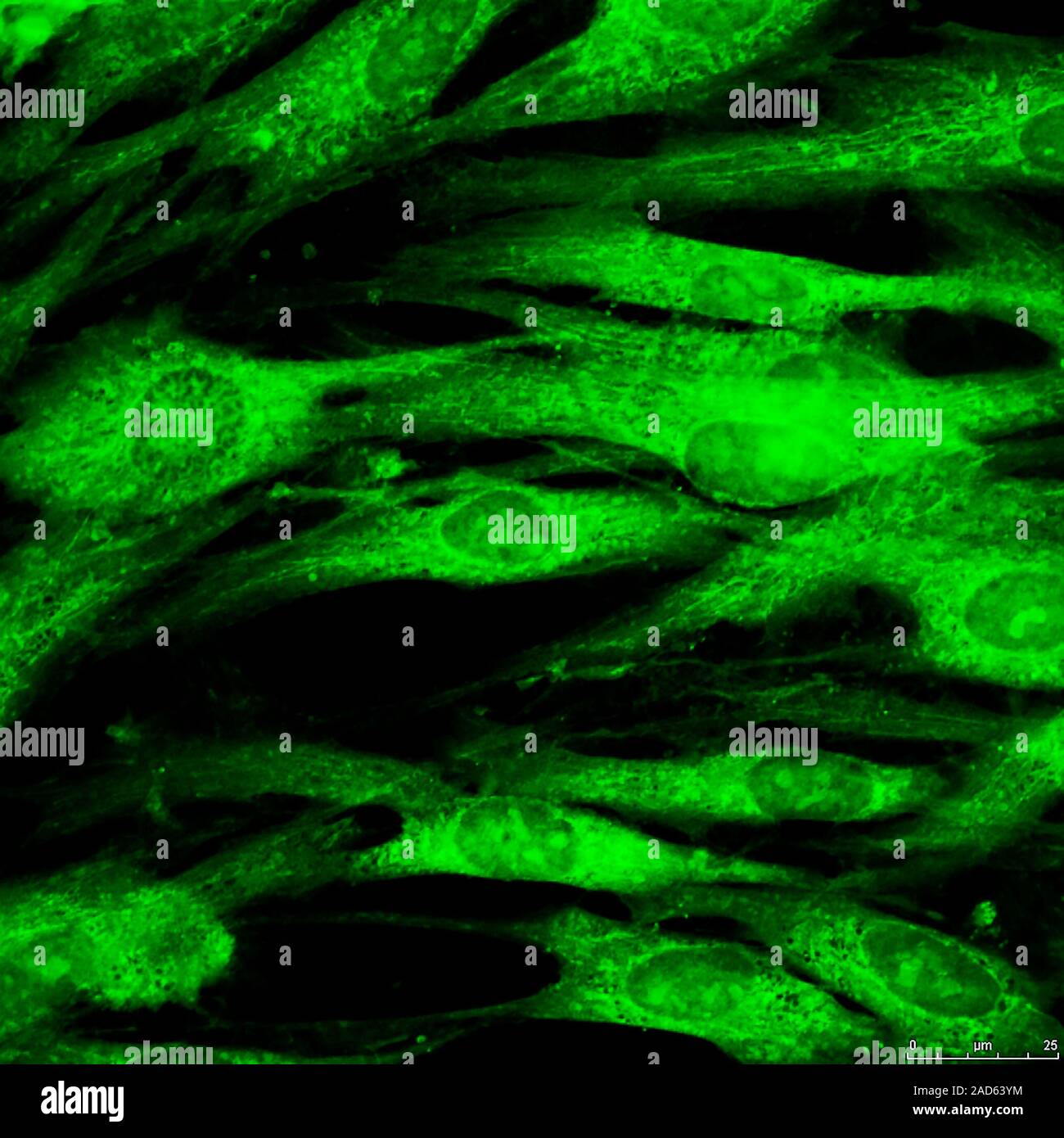 Fibroblast skin cells. Fluorescence light micrograph of fibroblast ...