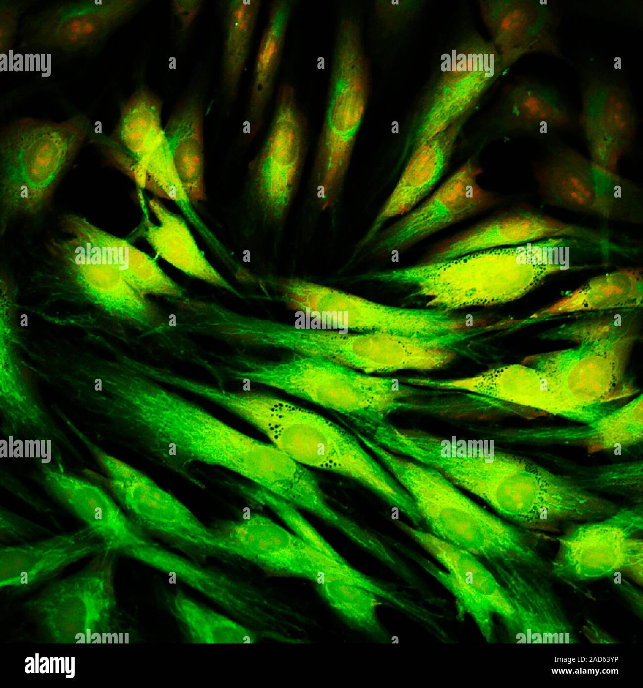 Fibroblast skin cells. Fluorescence light micrograph of fibroblast ...