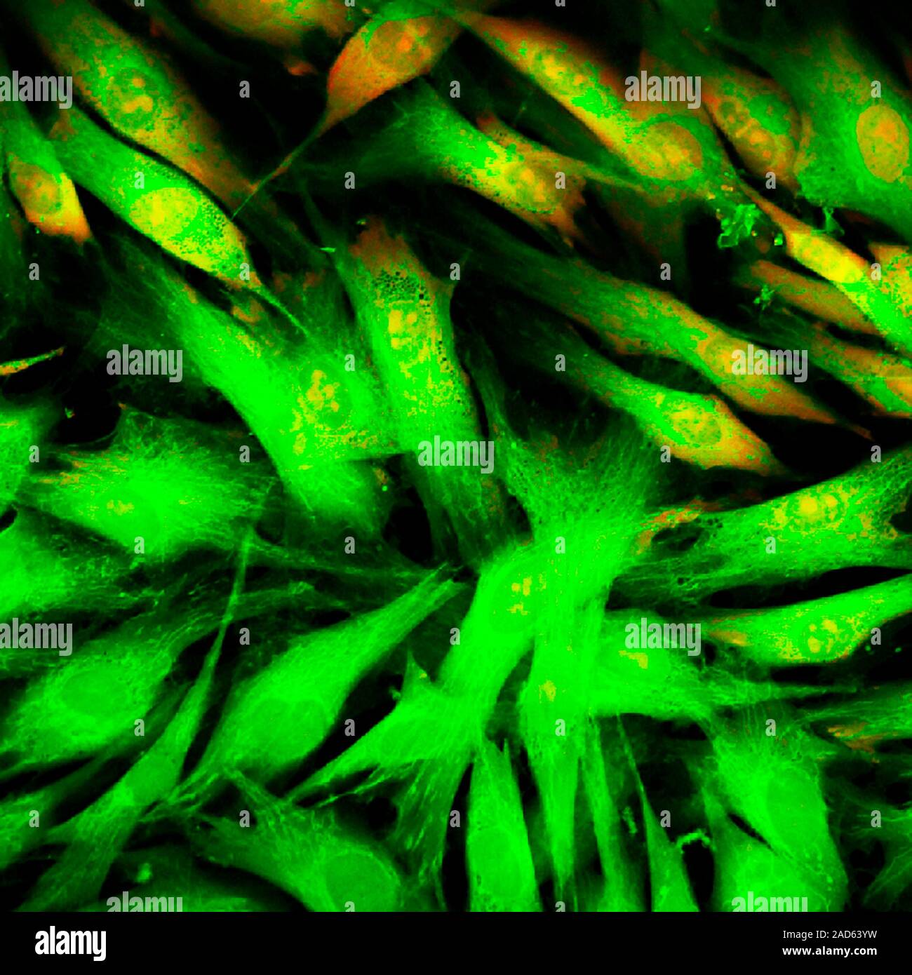 Fibroblast skin cells. Fluorescence light micrograph of fibroblast ...