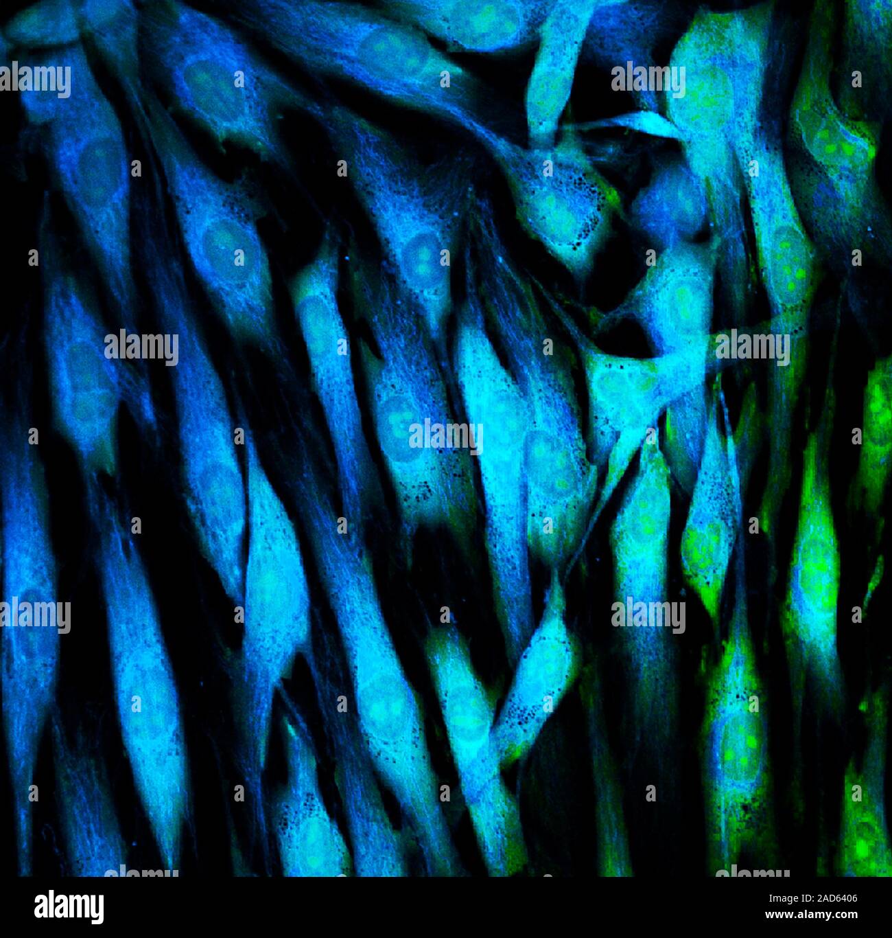 Fibroblast skin cells. Fluorescence light micrograph of fibroblast ...