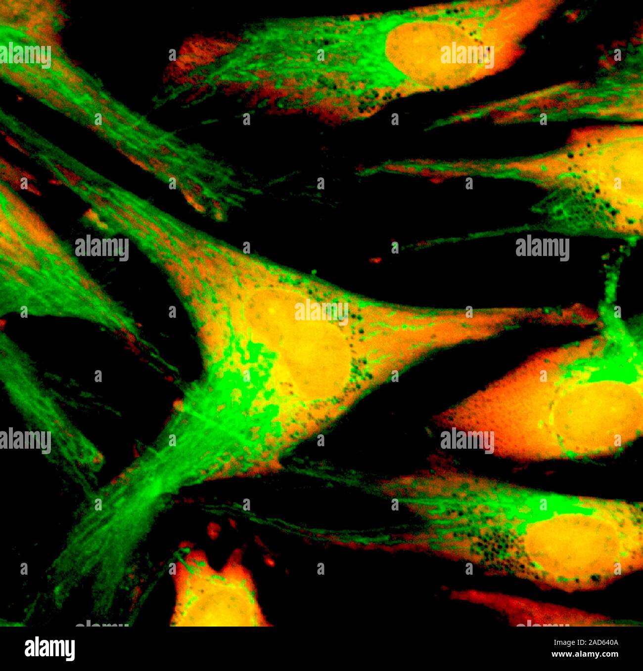Fibroblast skin cells. Fluorescence light micrograph of fibroblast ...