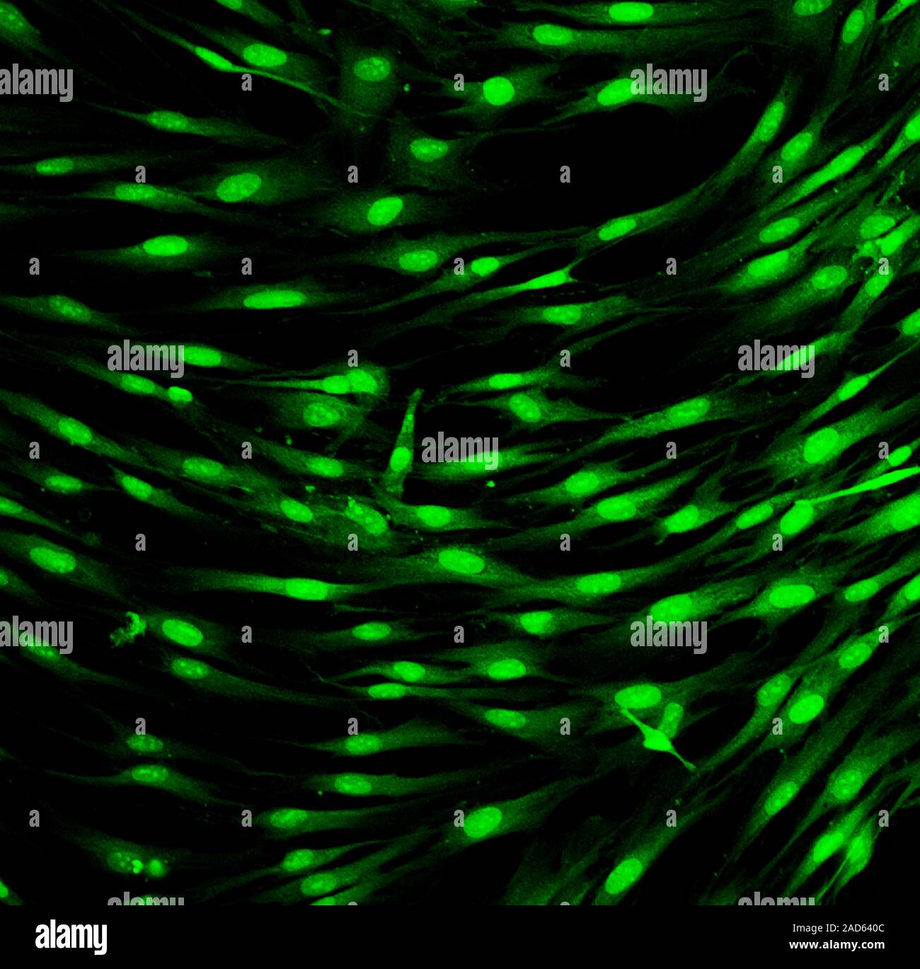 Fibroblast skin cells. Fluorescence light micrograph of fibroblast ...