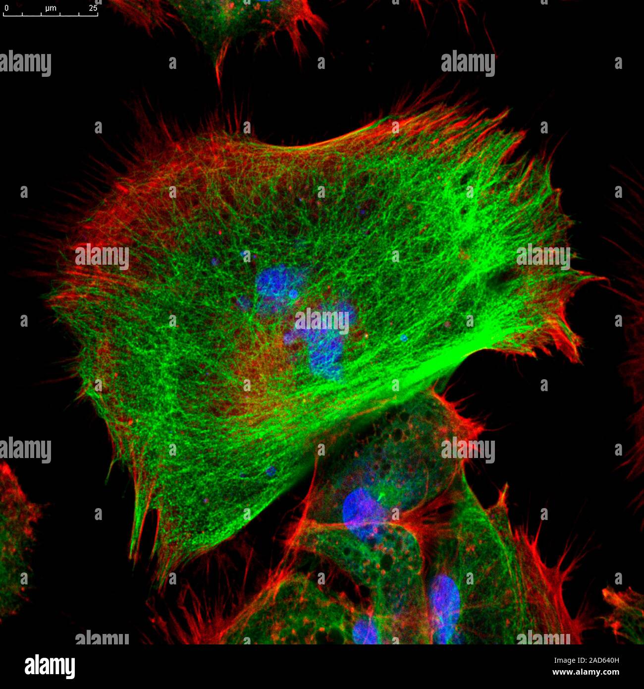 Fibroblast skin cells. Fluorescence light micrograph of fibroblast ...