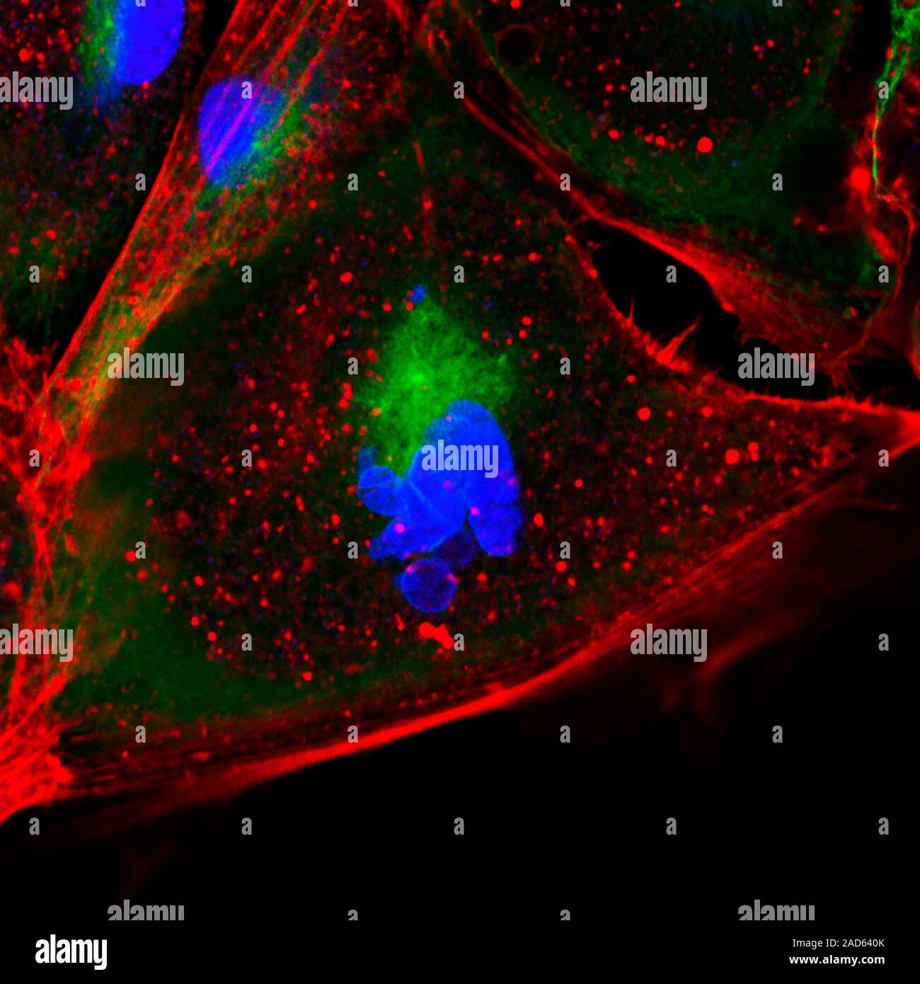 Fibroblast skin cells. Fluorescence light micrograph of fibroblast ...