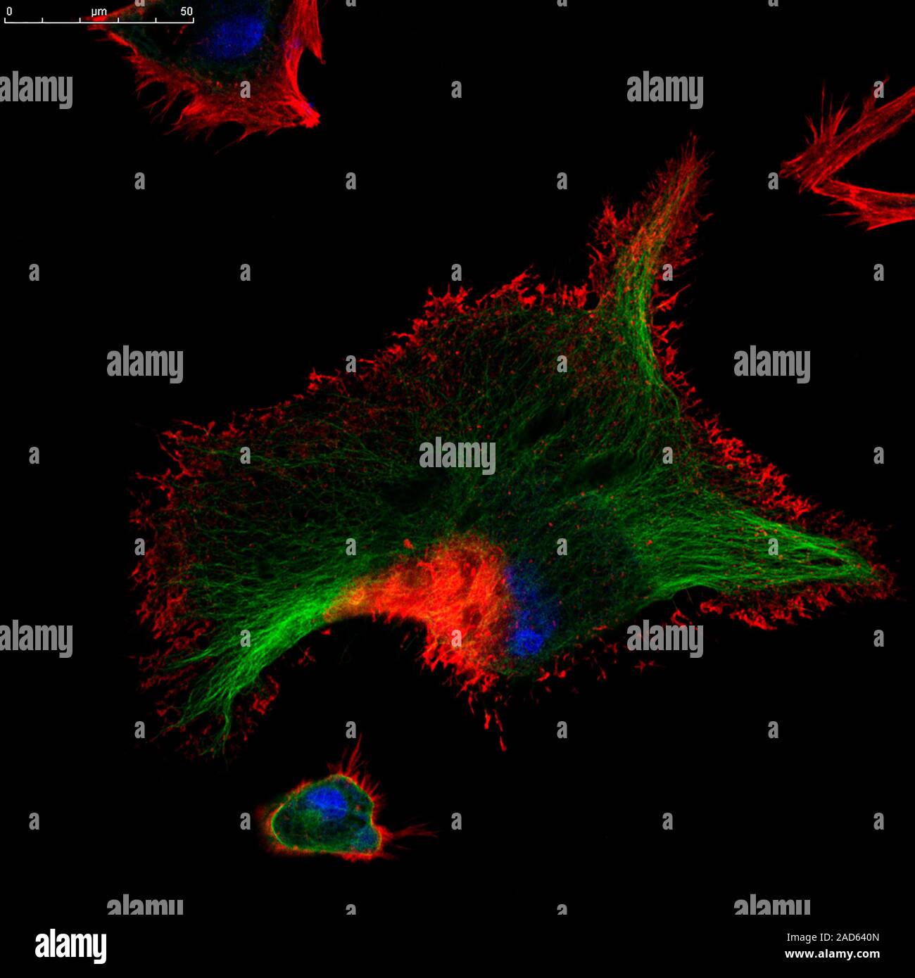 Fibroblast skin cells. Fluorescence light micrograph of fibroblast ...