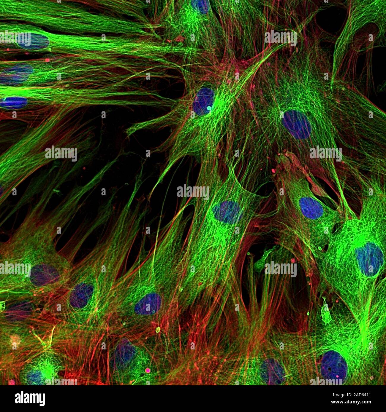 Fibroblast skin cells. Fluorescence light micrograph of fibroblast ...