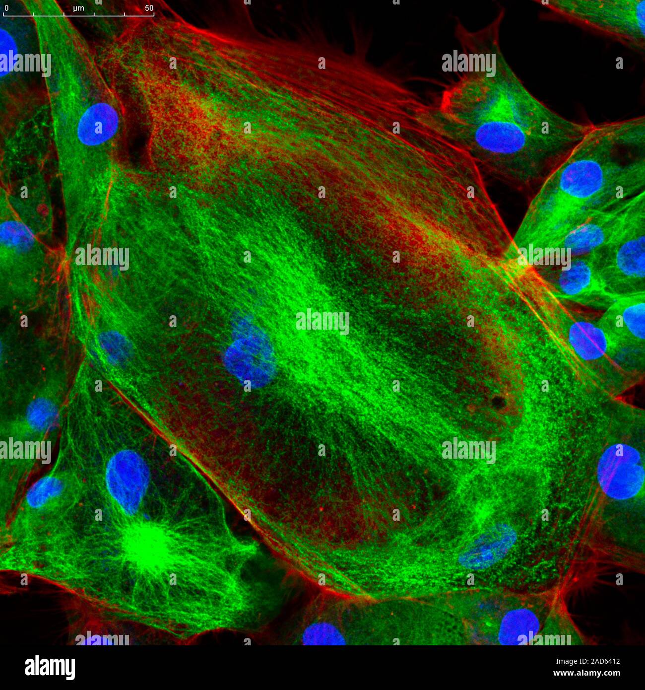 Fibroblast skin cells. Fluorescence light micrograph of fibroblast ...