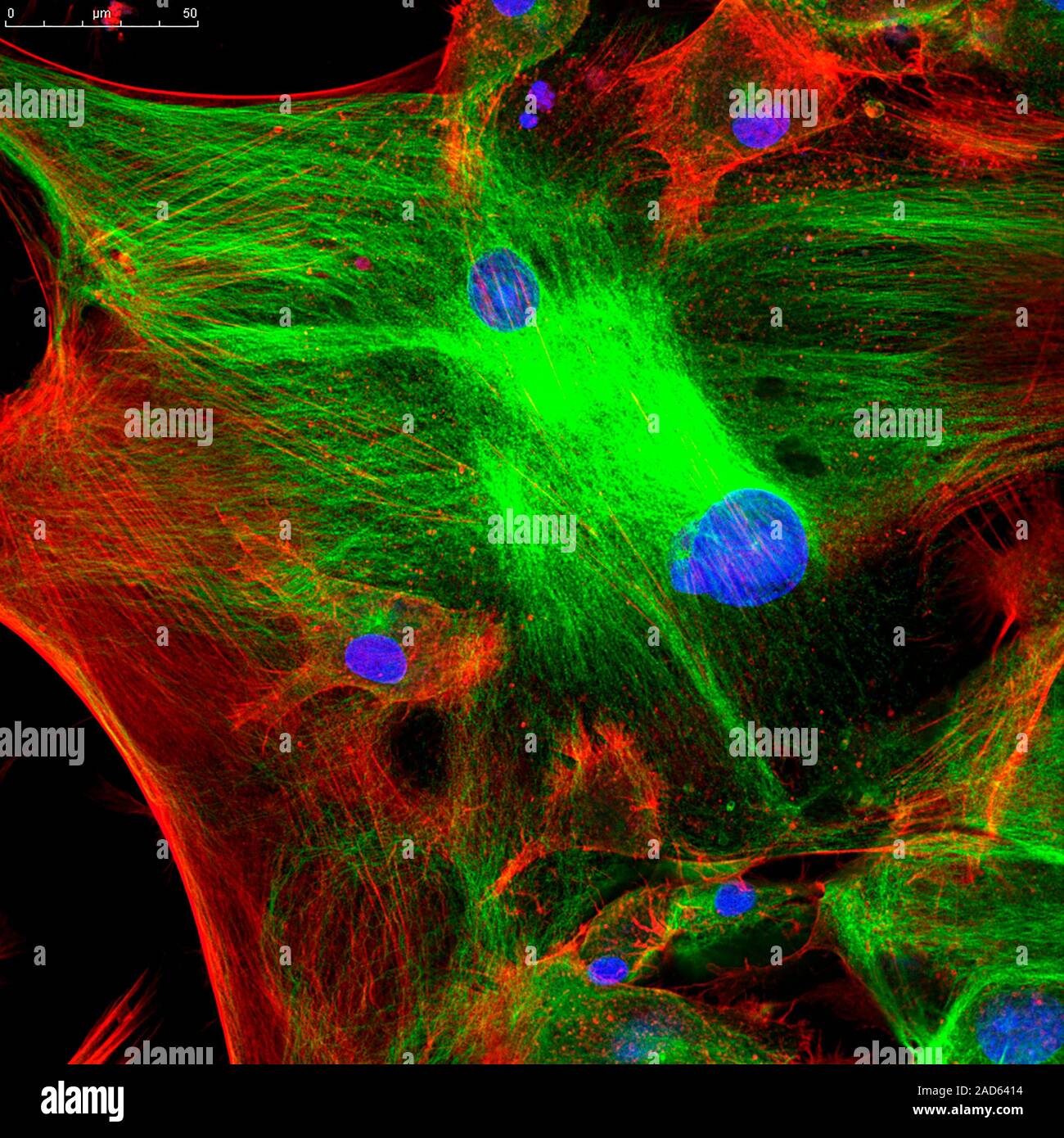 Fibroblast skin cells. Fluorescence light micrograph of fibroblast ...