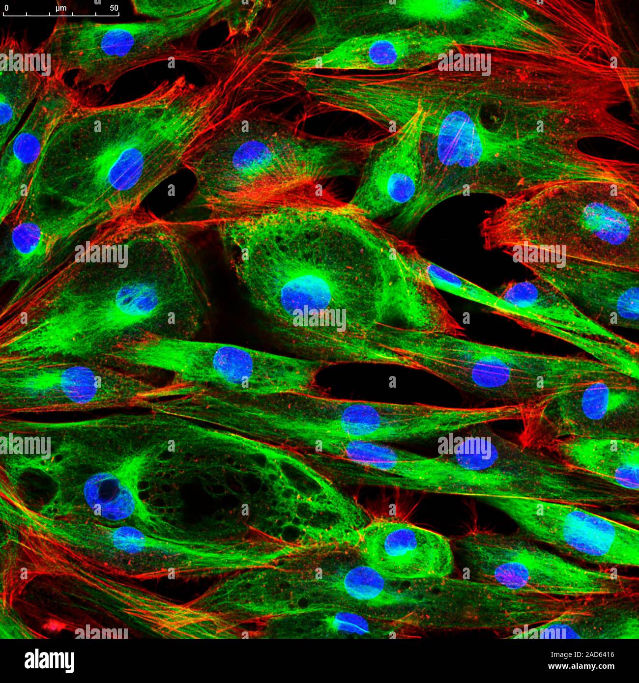 Fibroblast skin cells. Fluorescence light micrograph of fibroblast ...