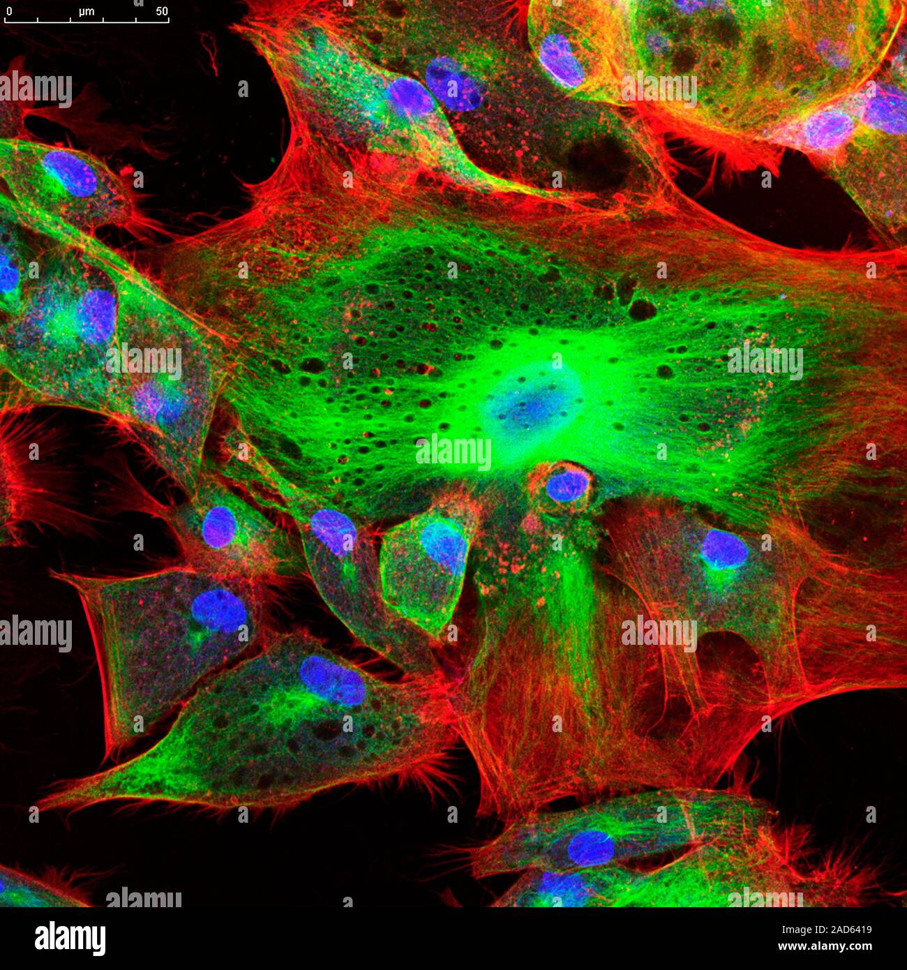 Fibroblast skin cells. Fluorescence light micrograph of fibroblast ...
