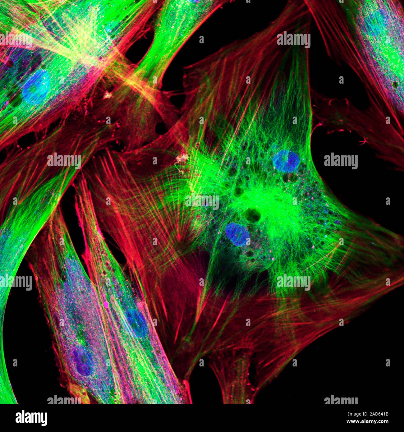 Fibroblast skin cells. Fluorescence light micrograph of fibroblast ...