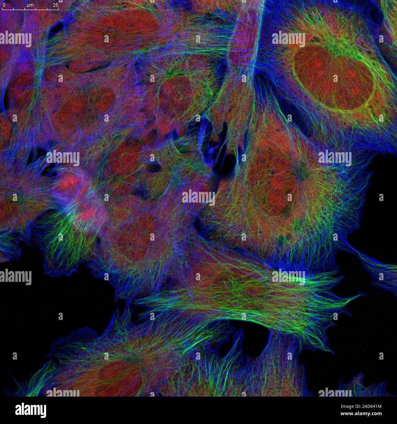 Fibroblast skin cells. Fluorescence light micrograph of fibroblast ...