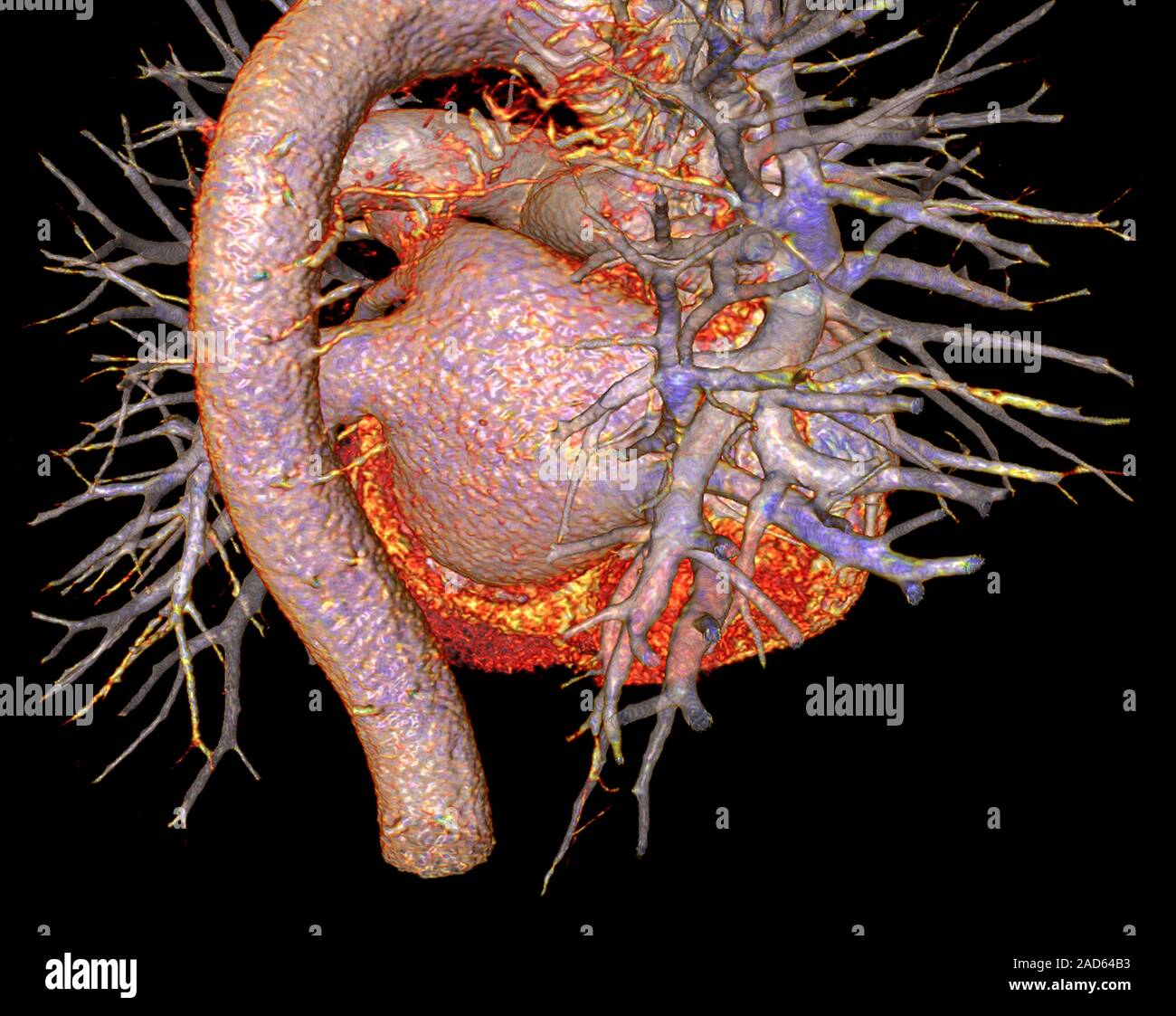 Human heart. Illustration based on a 3D computed tomography (CT) scan ...