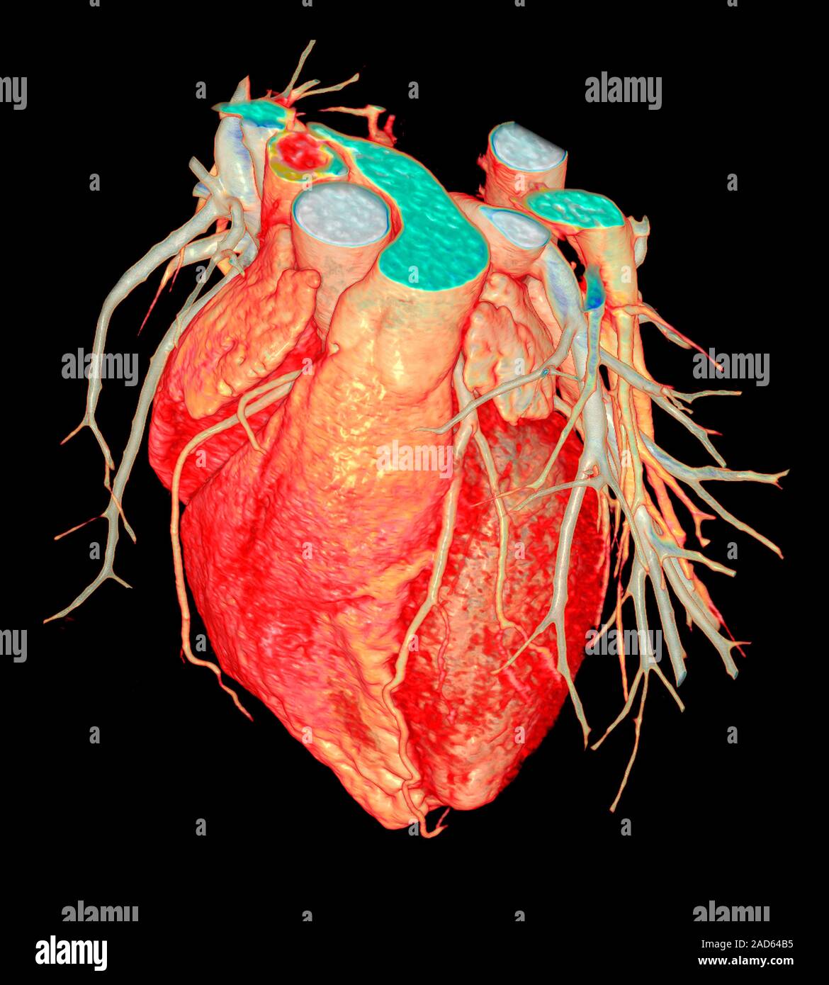 Human heart. Illustration based on a 3D computed tomography (CT) scan ...