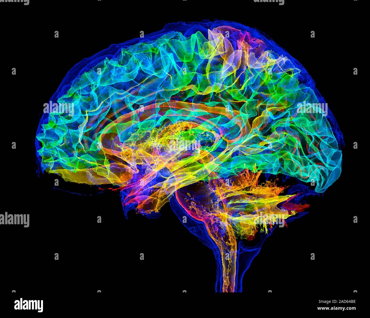 Human brain. Digitally enhanced 3D magnetic resonance imaging (MRI) scan of a normal human brain ...