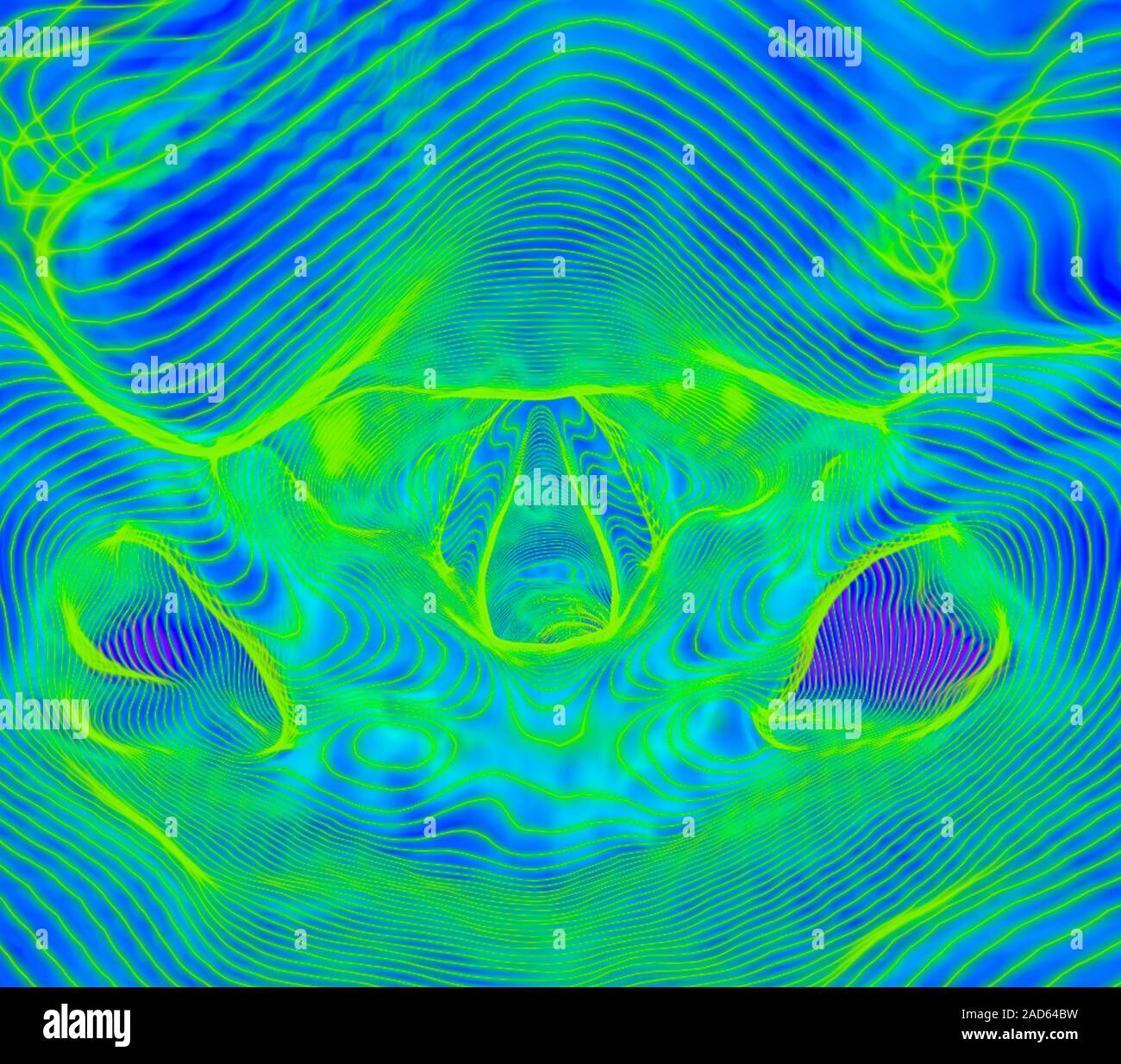 Larynx. Illustration based on a 3D computed tomography (CT) scan of a ...