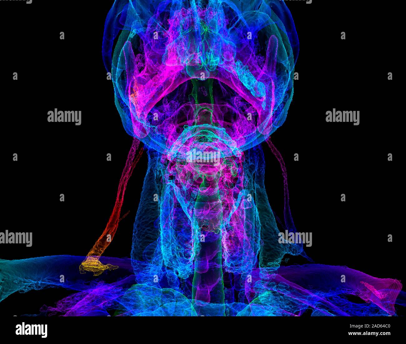 Ct Anatomy Of The Neck