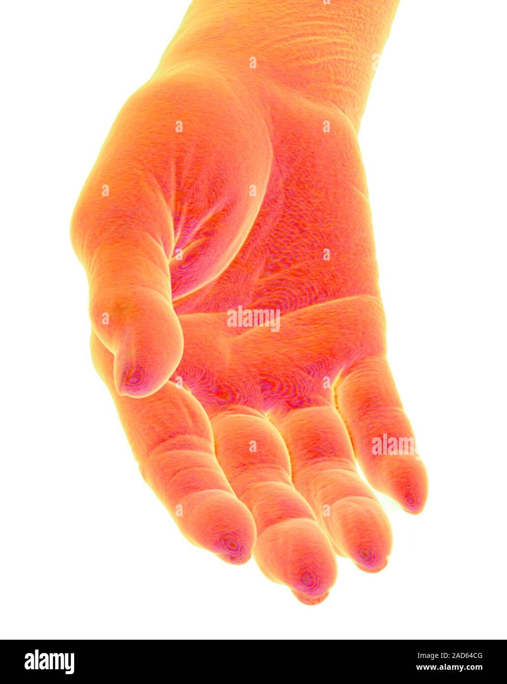 Human hand. Digitally enhanced 3D computed tomography (CT) scan of a ...