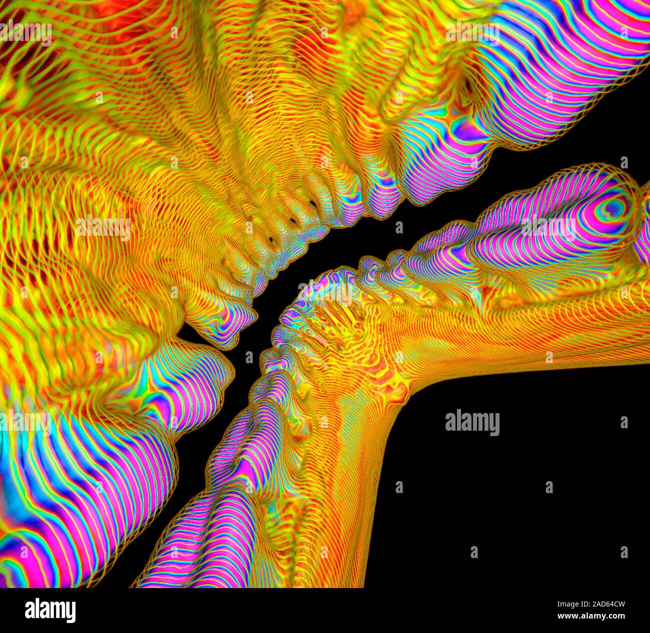 Teeth anatomy. Digitally enhanced 3D computed tomography (CT) scan of a ...