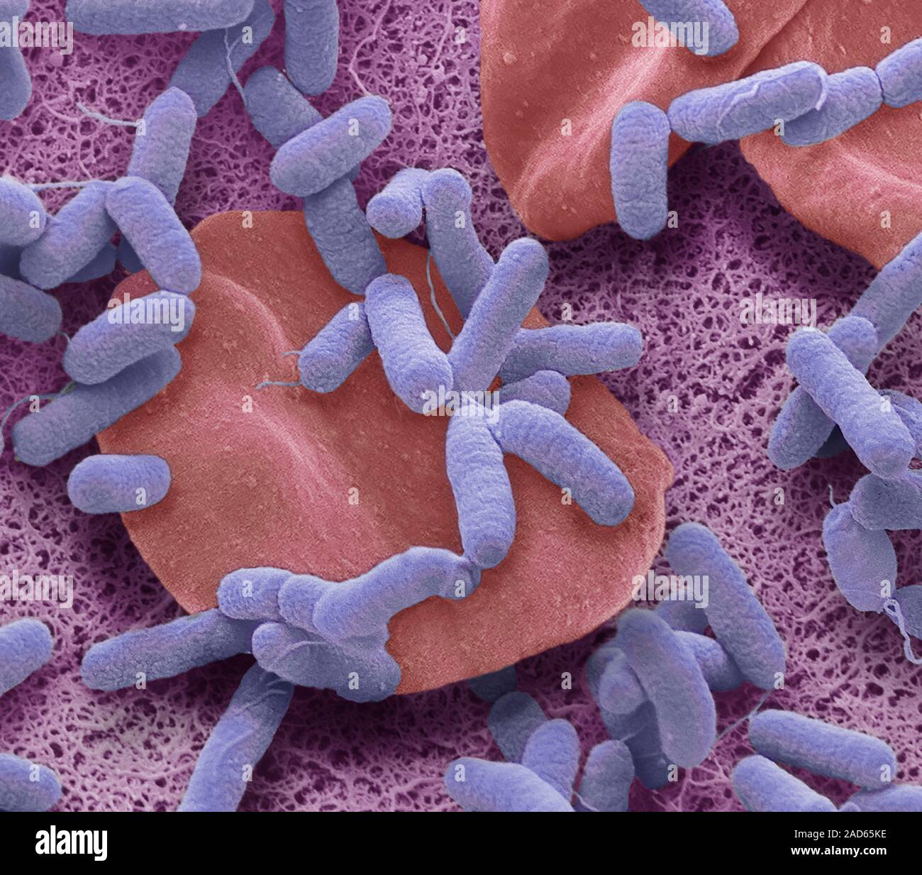 Sepsis. Composite coloured scanning electron micrograph (SEM). Bacteria ...