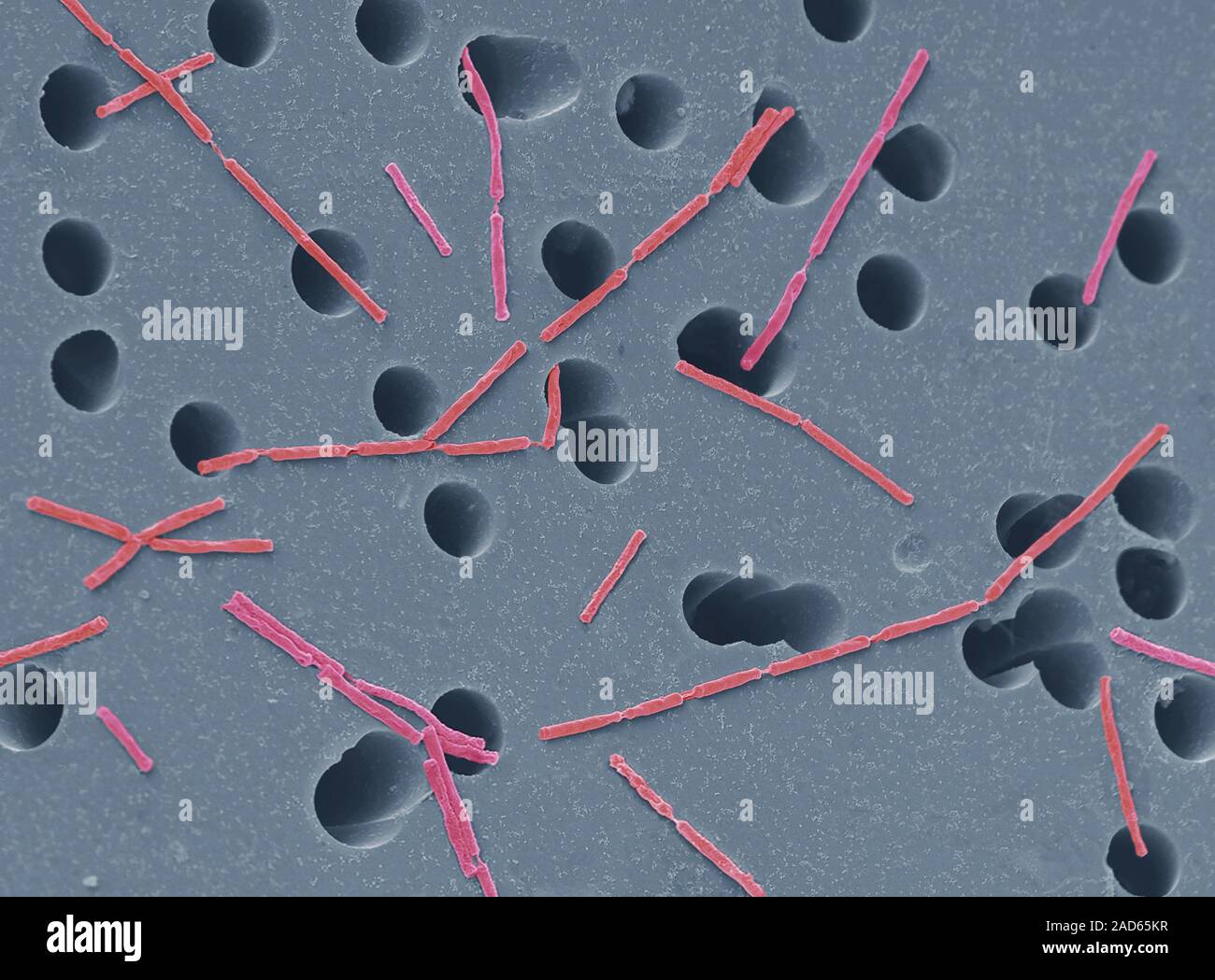Coloured Scanning Electron Micrograph Sem Of An Archaea Extremophile