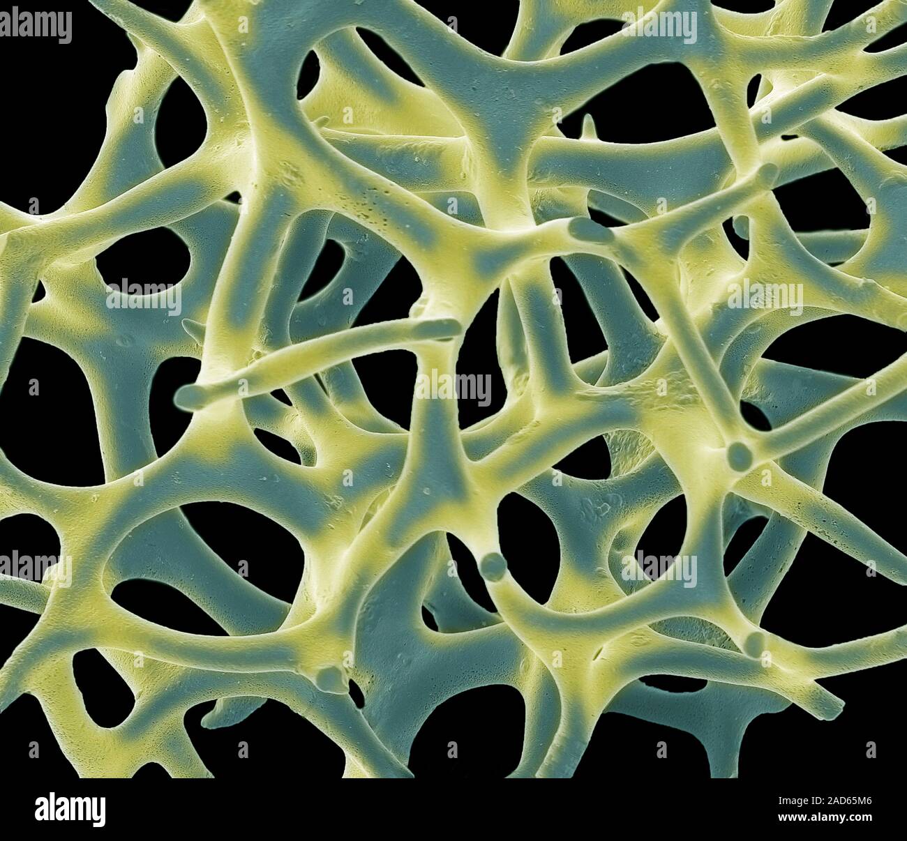 Radiolarian test. coloured scanning electron micrograph (SEM). The hard ...