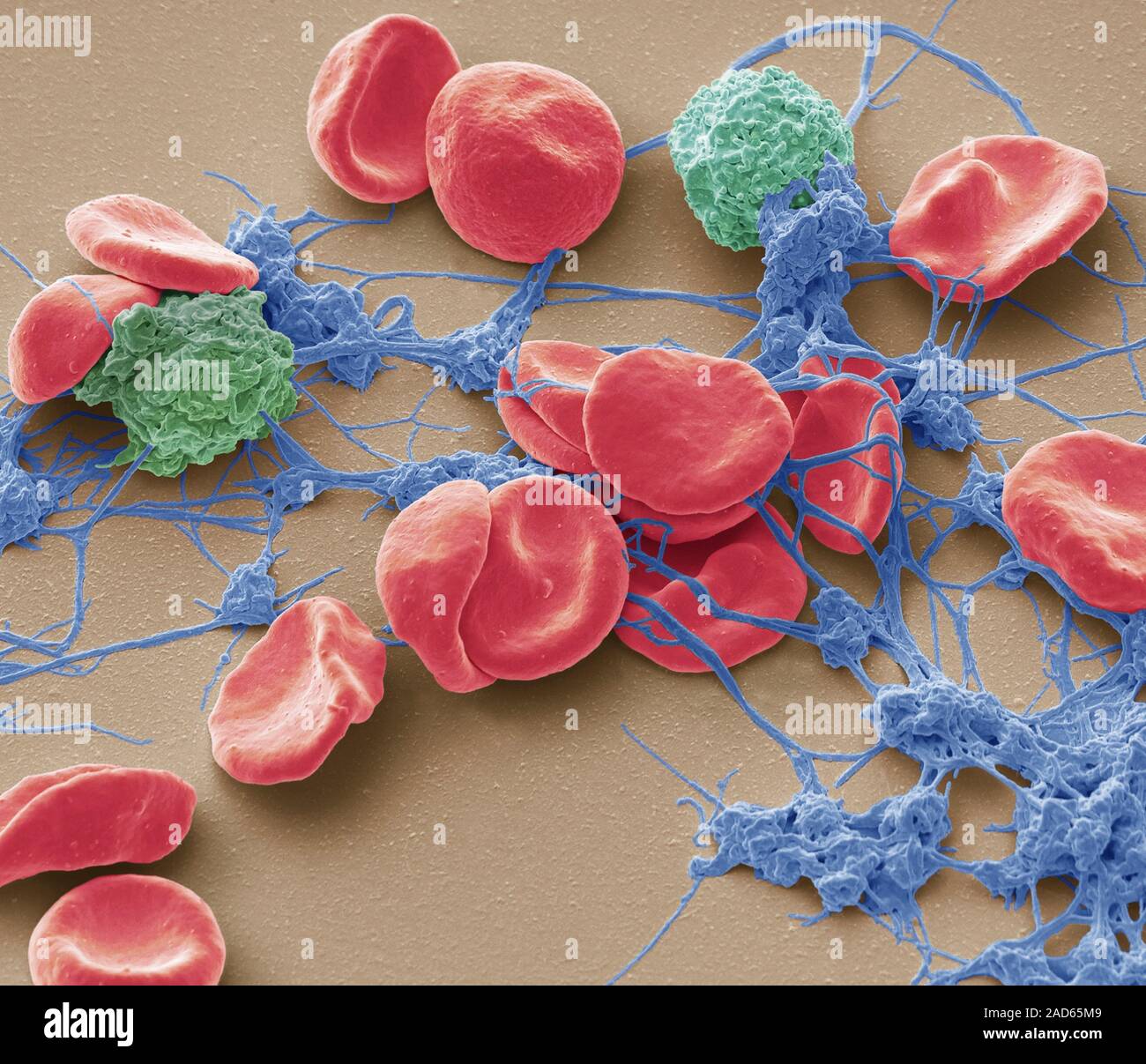 Skin wound, Coloured scanning electron micrograph (SEM) of a variety of ...