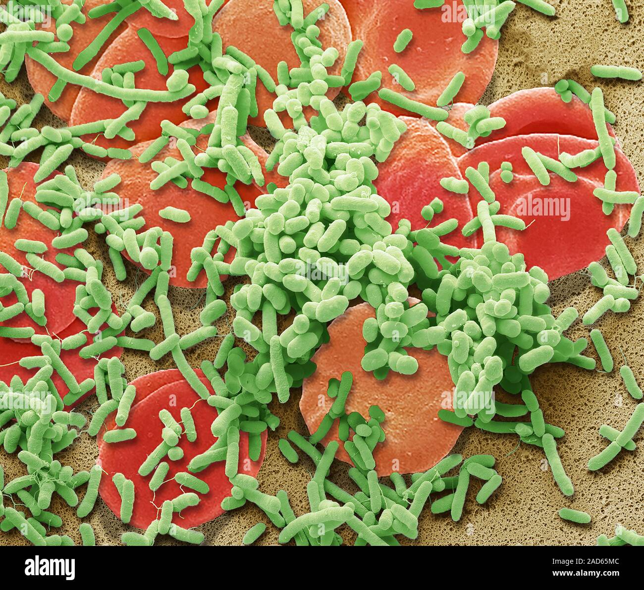Sepsis. Composite coloured scanning electron micrograph (SEM). Bacteria ...