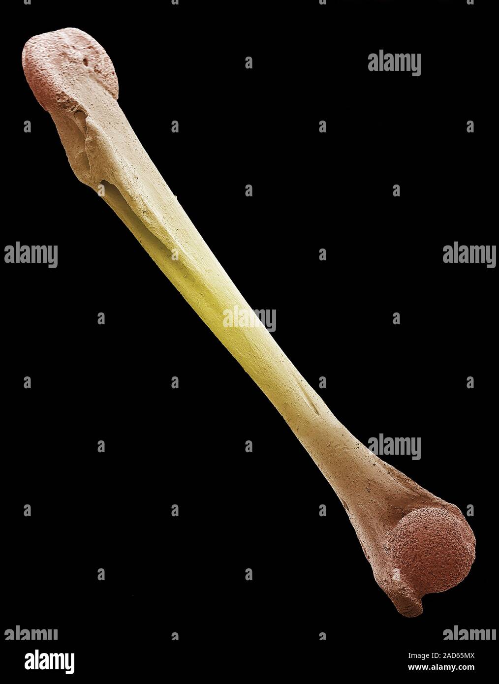 Fossil frog humerus. Coloured scanning electron micrograph (SEM) of the ...