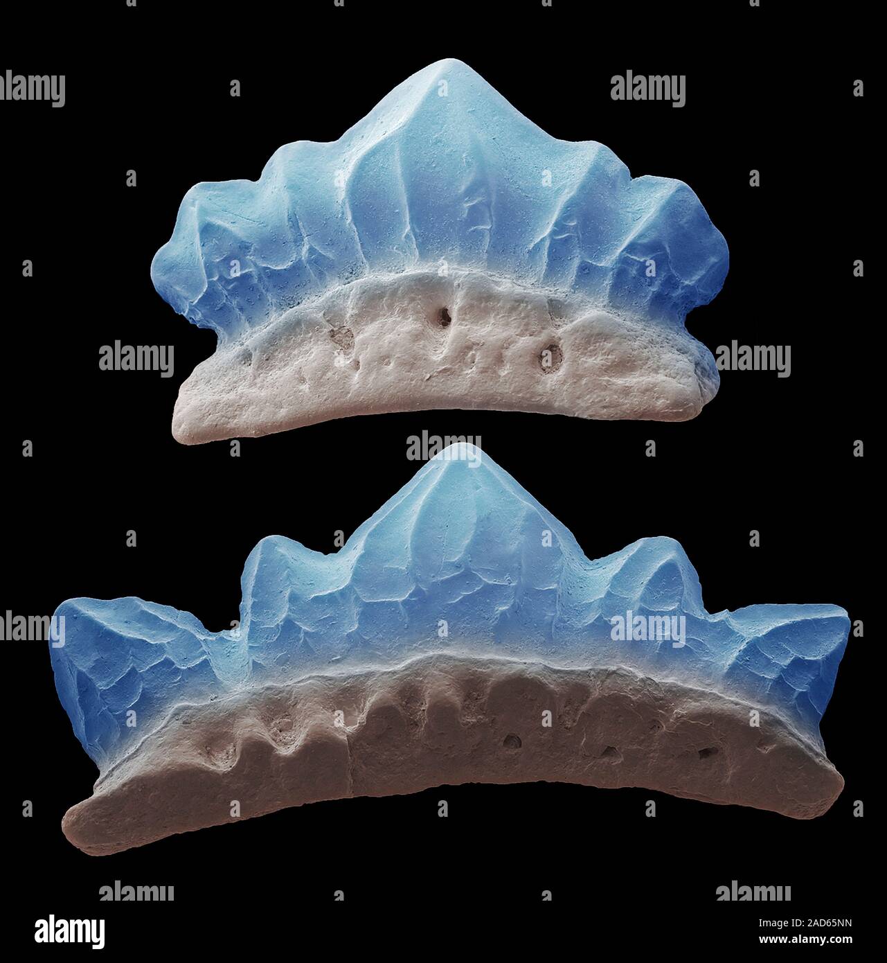 Prodacrodus shark teeth fossils. Coloured scanning electron micrograph ...