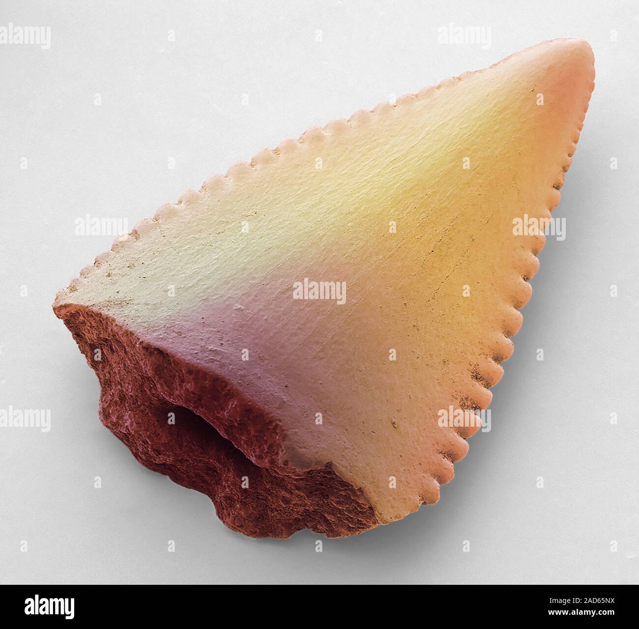 Phytosaur tooth fossil. Coloured scanning electron micrograph (SEM ...