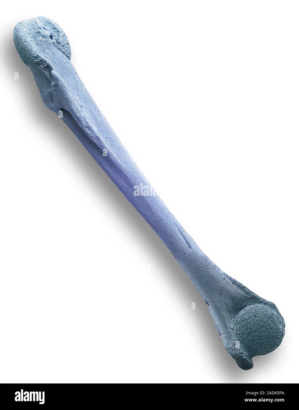 Fossil frog humerus. Coloured scanning electron micrograph (SEM) of the ...